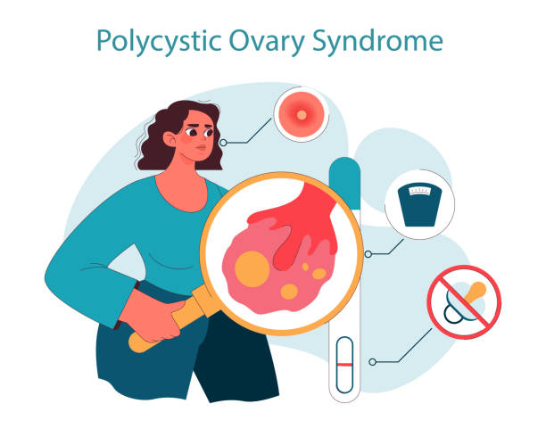 70 Woman Pcos Stock Illustrations Royalty Free Vector Graphics And Clip