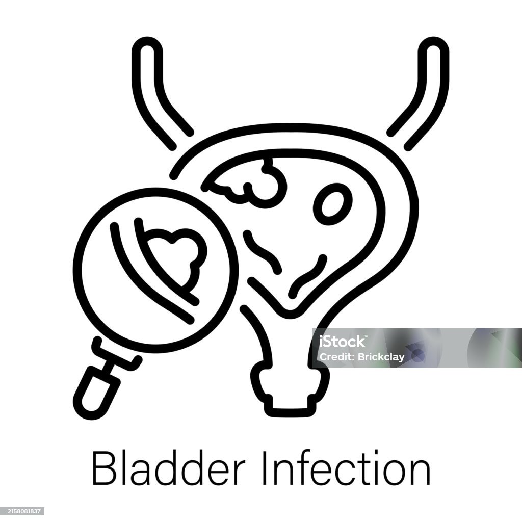 Bladder Infection Stock Illustration Download Image Now Bladder Cystitis Healthcare And