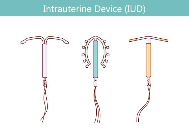 140 Coil Iud Stock Illustrations Royalty Free Vector Graphics And Clip