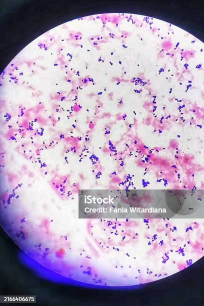 Gram Positive Cocci Bacteria In Gram Staining Gram Positive Diplococci Microbiology Lab Stock
