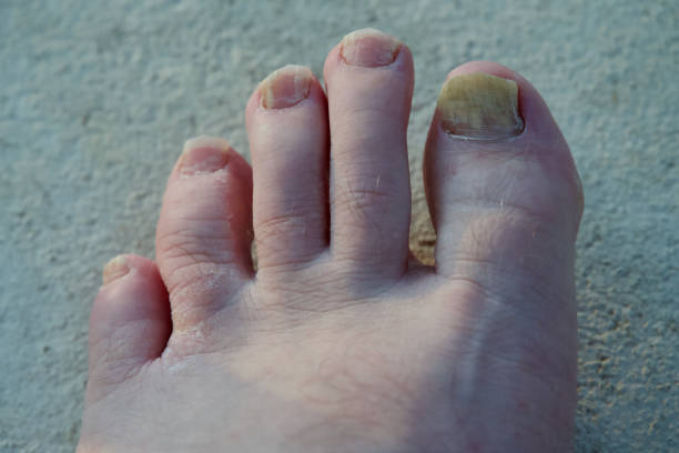 3,000+ Free Ugly Feet & Feet Photos - Pixabay