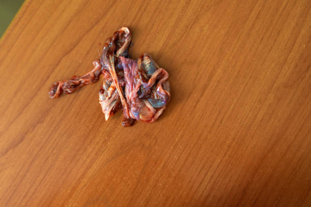 4,000+ Free Brain Rot & Brain Images - Pixabay