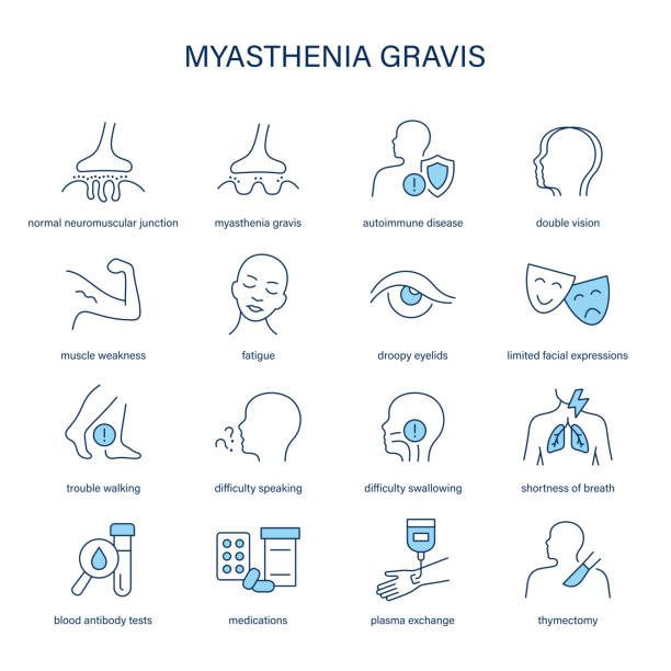 40+ Myasthenia Gravis Stock Illustrations, Royalty-Free Vector Graphics ... 40+ Myasthenia Gravis Stock Illustrations, Royalty-Free Vector Graphics ...