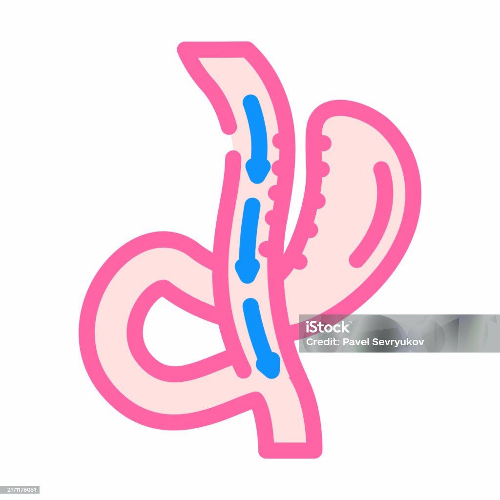 Anastomosis Surgery Color Icon Vector Illustration Stock Illustration Download Image Now