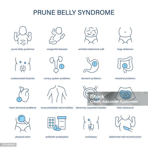 Prune Belly Syndrome Symptoms Diagnostic And Treatment Vector Icons Stock Illustration