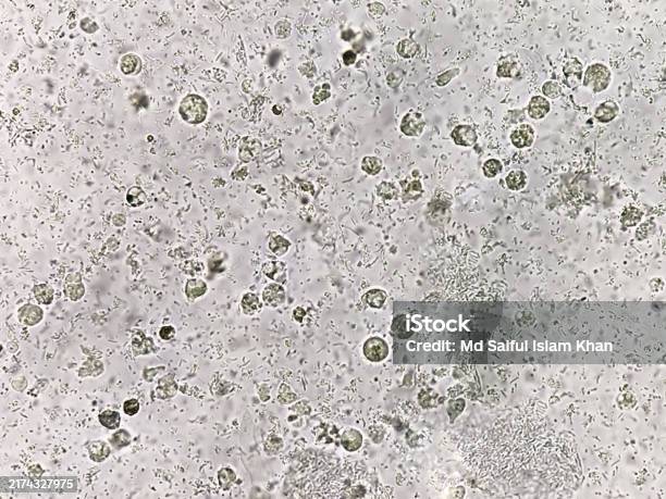 Microscopic View Of Stool Sample Showing Cyst Of Entamoeba Histolytica