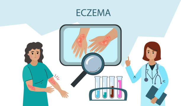Atopic dermatitis Clipart Vector PNG , SVG, EPS, PSD, AI