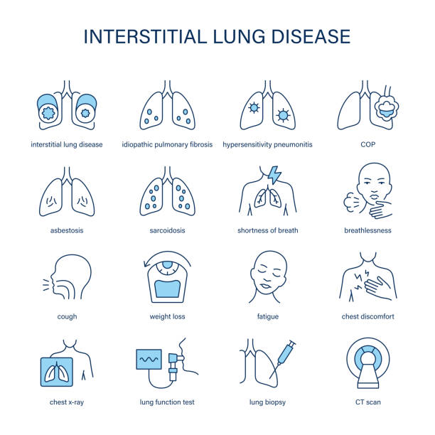 40 Bronchiolitis Stock Illustrations Royalty Free Vector Graphics