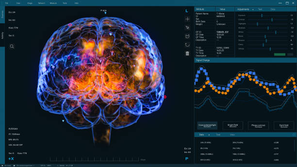 Free neural monitoring stock photos. Download the best free neural ...