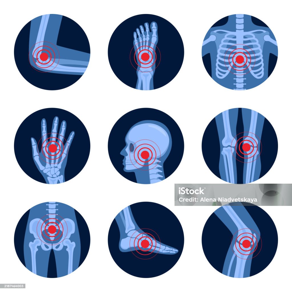 Parts Of Human Body On X Ray View Different Xrays Shot Of Human Body