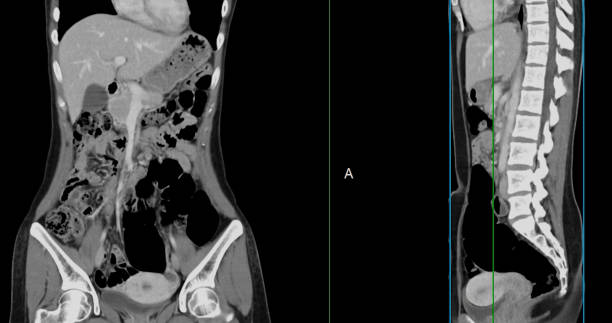 Contrast-enhanced CT whole abdomen study revealing normal anatomical ...