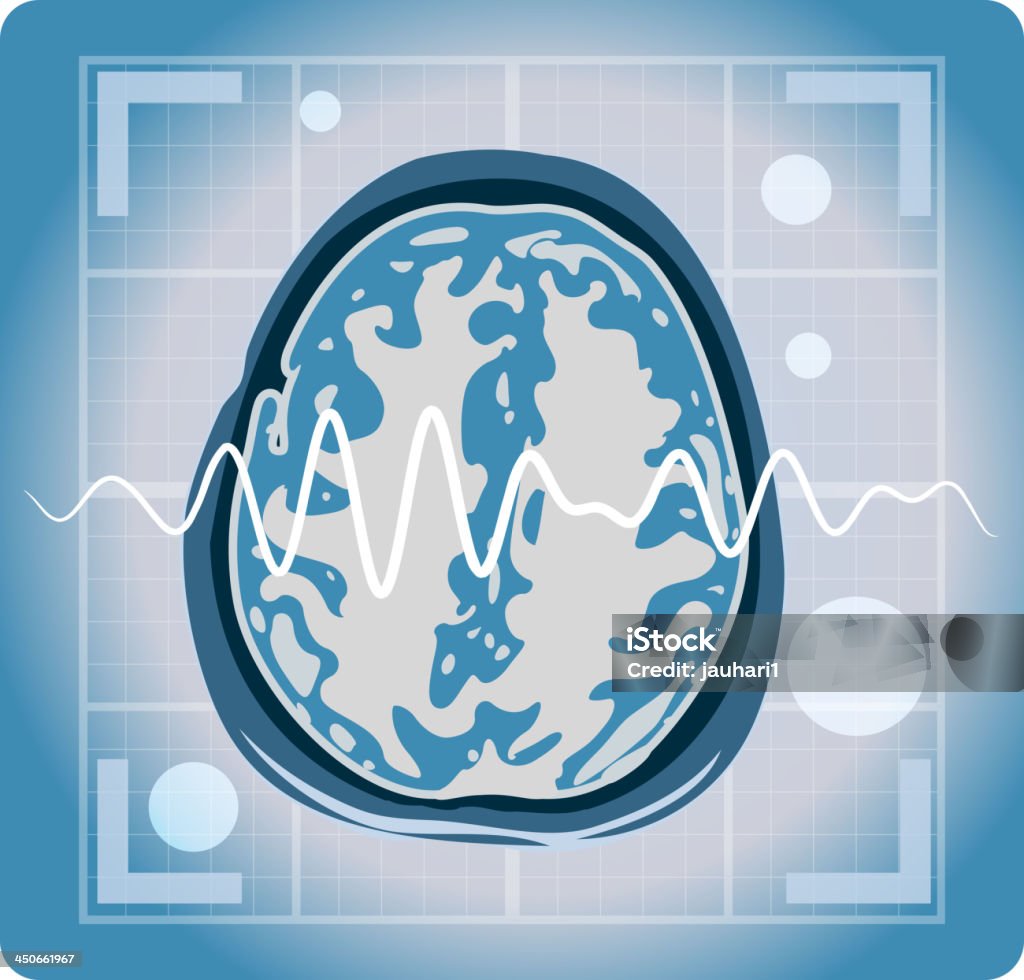 Pencitraan Resonansi Magnetik Mri Otak Ilustrasi Stok - Unduh Gambar ... Pencitraan Resonansi Magnetik Mri Otak Ilustrasi Stok - Unduh Gambar ...