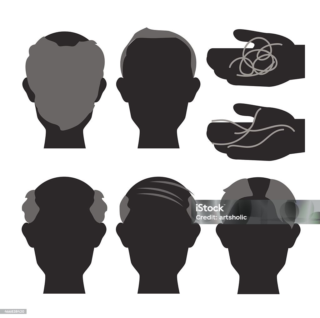 Hair Loss2 Stock Illustration Download Image Now Alopecia Hair