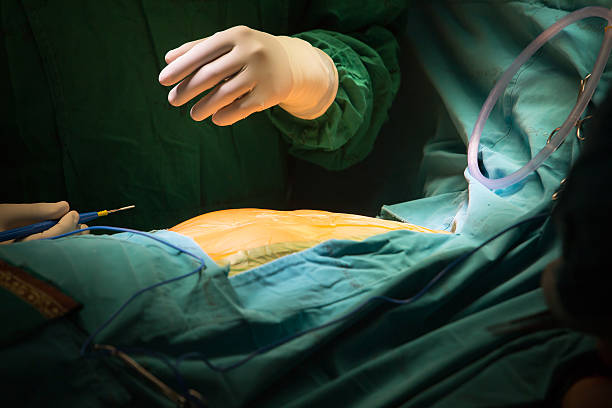 Surgical Incision Stock Photos, Pictures & Royalty-Free Images - iStock Surgical Incision Stock Photos, Pictures & Royalty-Free Images - iStock