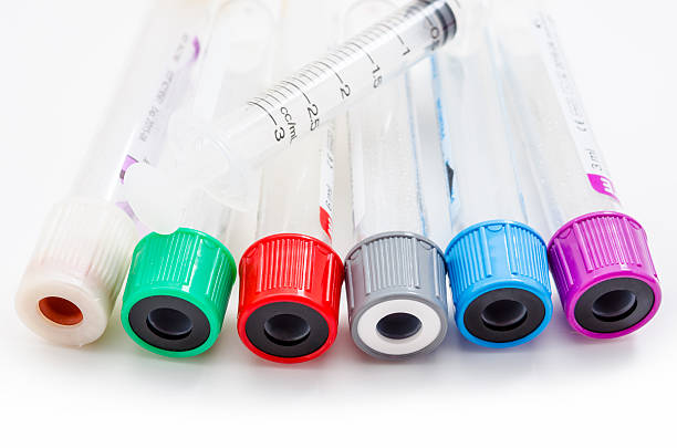 Free Stock Photo of Blood Draw Tubes | Download Free Images and Free ...