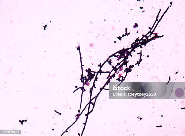 Percabangan Tunas Sel Ragi Dengan Pseudohyphae Dalam Urin Gram St Foto