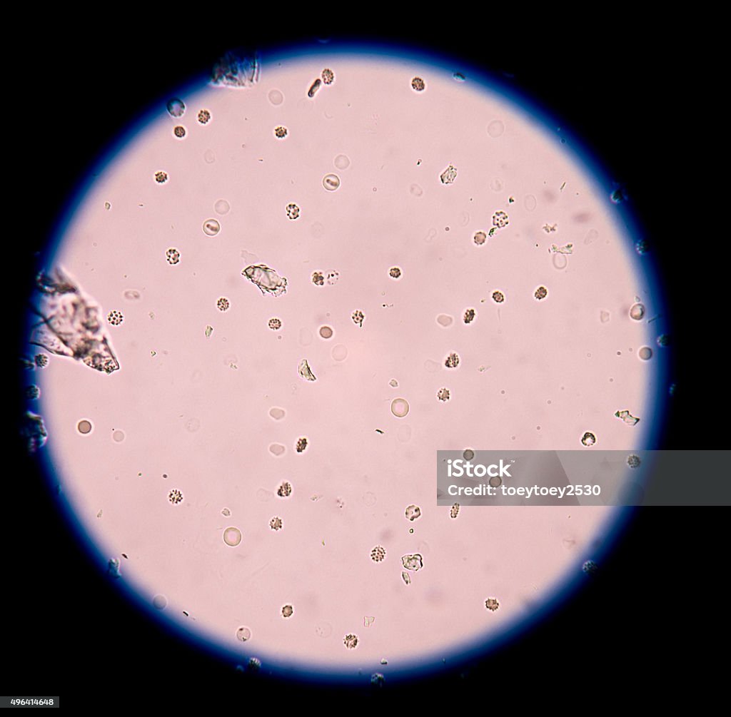 Fresca De Eritrocitos Leucocitos En La Orina Examen Foto de stock y más ... Fresca De Eritrocitos Leucocitos En La Orina Examen Foto de stock y más ...