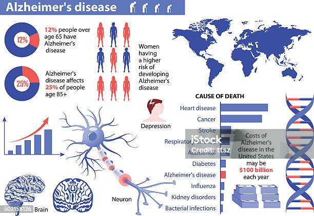 Alzheimer의 질병입니다 의료 인포그래픽 알츠하이머병에 대한 스톡 벡터 아트 및 기타 이미지 알츠하이머병 치매