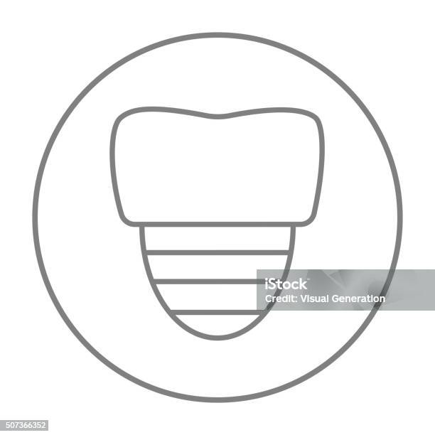 Ikon Garis Implan Gigi Ilustrasi Stok - Unduh Gambar Sekarang - Desain ... Ikon Garis Implan Gigi Ilustrasi Stok - Unduh Gambar Sekarang - Desain ...