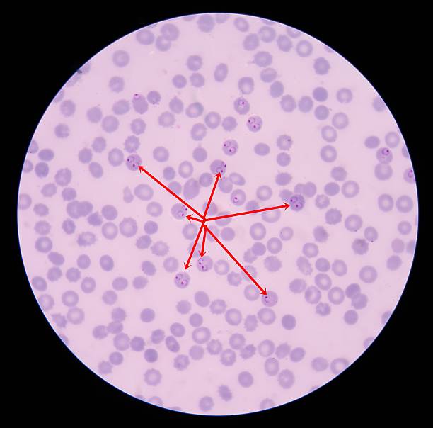 Free picture: malariae, quartan, malaria, febrile, paroxysms, cycle