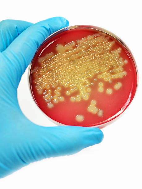 Acinetobacter Stock Photos, Pictures & Royalty-Free Images - iStock Acinetobacter Stock Photos, Pictures & Royalty-Free Images - iStock