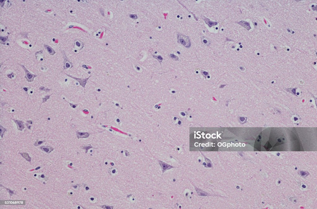 Normal Brain Tissue