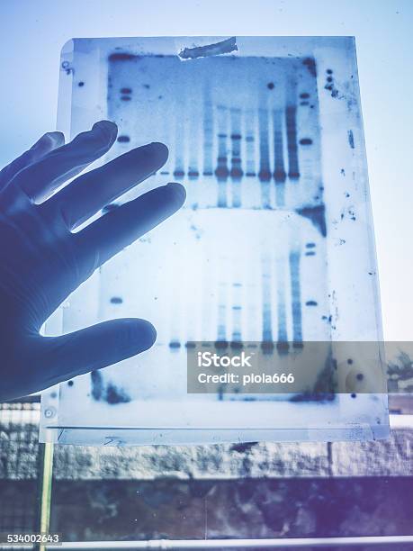 Dna 유전자 분석 결과 Dna 테스트에 대한 스톡 사진 및 기타 이미지 Dna 테스트 Electrophoresis