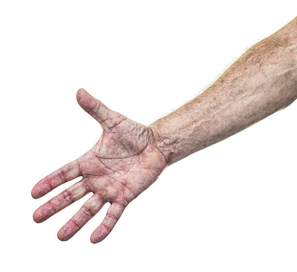 Forearm Pictures | Download Free Images on Unsplash