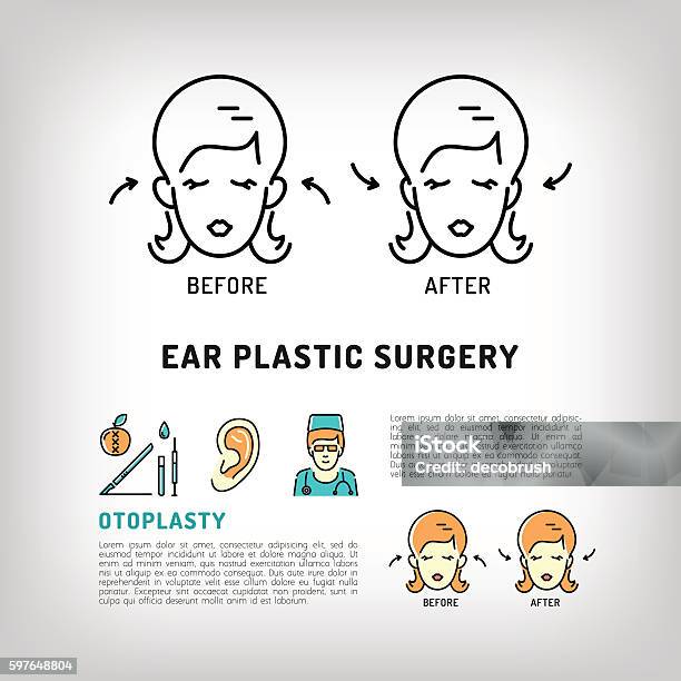 Otoplasty 귀 성형 수술 로고 화장품 절차 얇은 라인 아이콘 건강관리와 의술에 대한 스톡 벡터 아트 및 기타 이미지