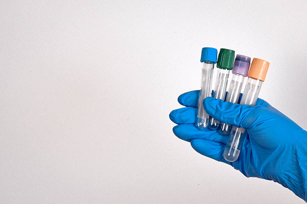 Free Stock Photo of Hand Holding Blood Draw Tube | Download Free Images ...