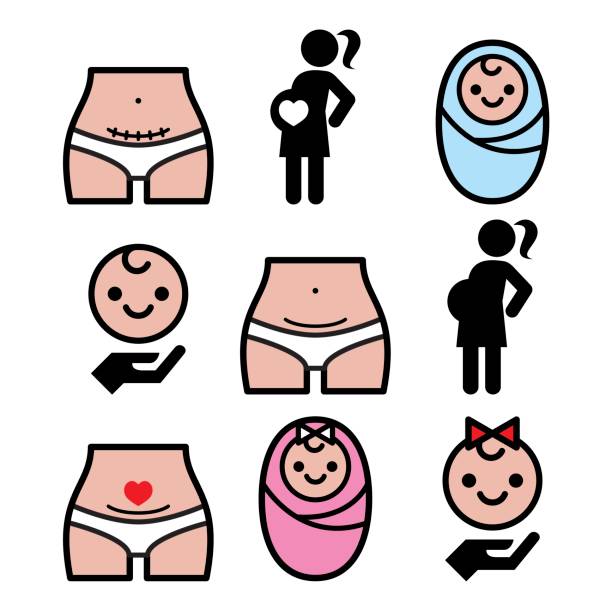 310 Caesarean Section Stock Illustrations Royalty Free Vector