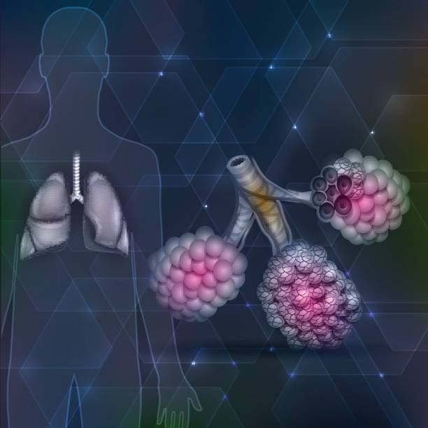 120+ Alveoli Damage Stock Illustrations, Royalty-Free Vector Graphics ... 120+ Alveoli Damage Stock Illustrations, Royalty-Free Vector Graphics ...