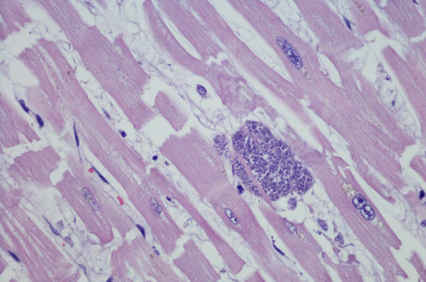 Free picture: several, myocardial, contraction, bands, scattered ...
