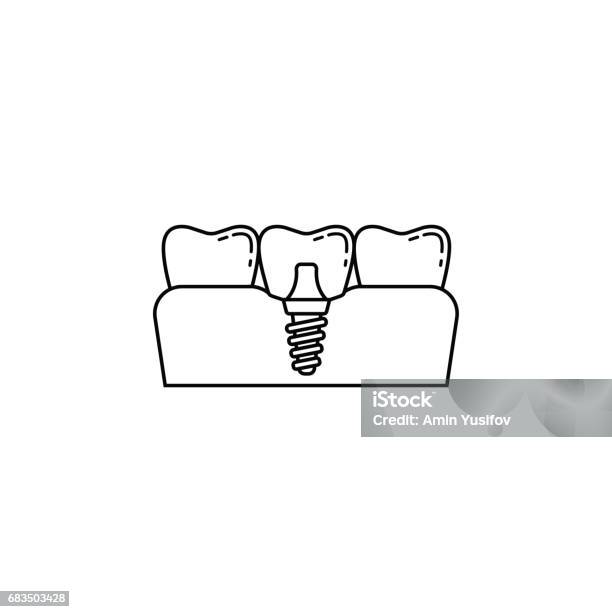 Ikon Garis Implan Gigi Ilustrasi Stok - Unduh Gambar Sekarang - Akar ... Ikon Garis Implan Gigi Ilustrasi Stok - Unduh Gambar Sekarang - Akar ...