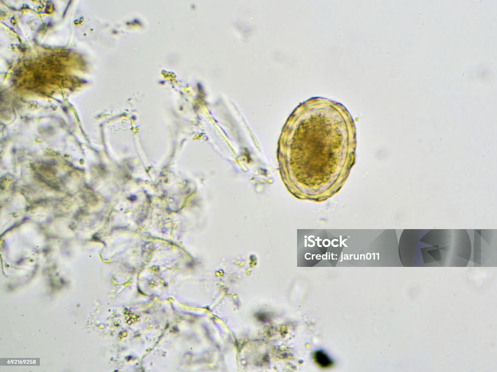 Ascaris Lumbricoides Foto De Stock Y Más Banco De Imágenes De Analizar Analizar Ciencia