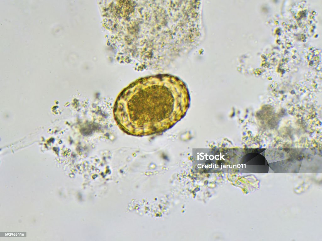 Ascaris Lumbricoides Foto De Stock Y Más Banco De Imágenes De Analizar