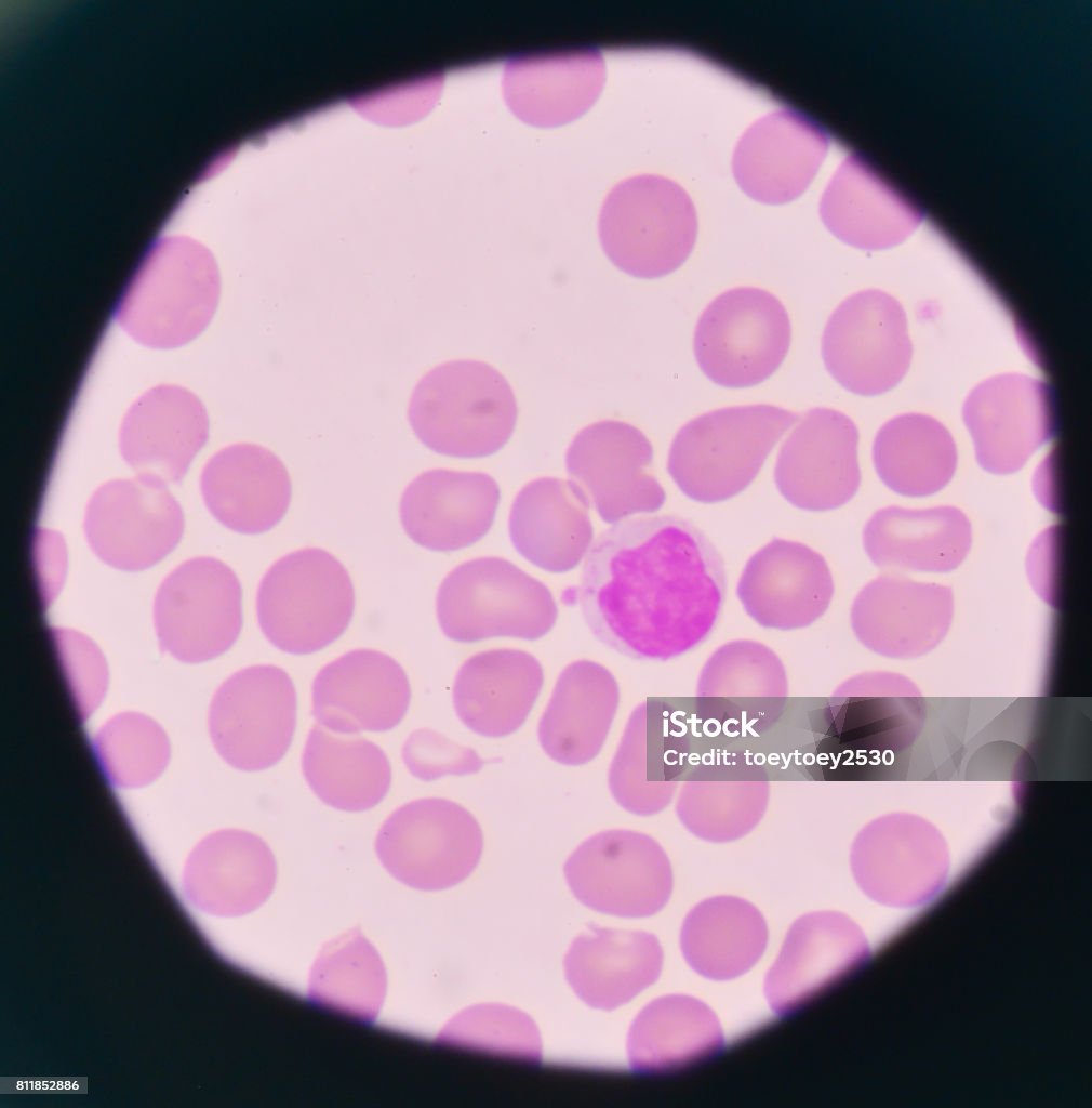 Sel Darah Putih Foto Stok Unduh Gambar Sekarang Biologi Darah Fotografi Citra Istock
