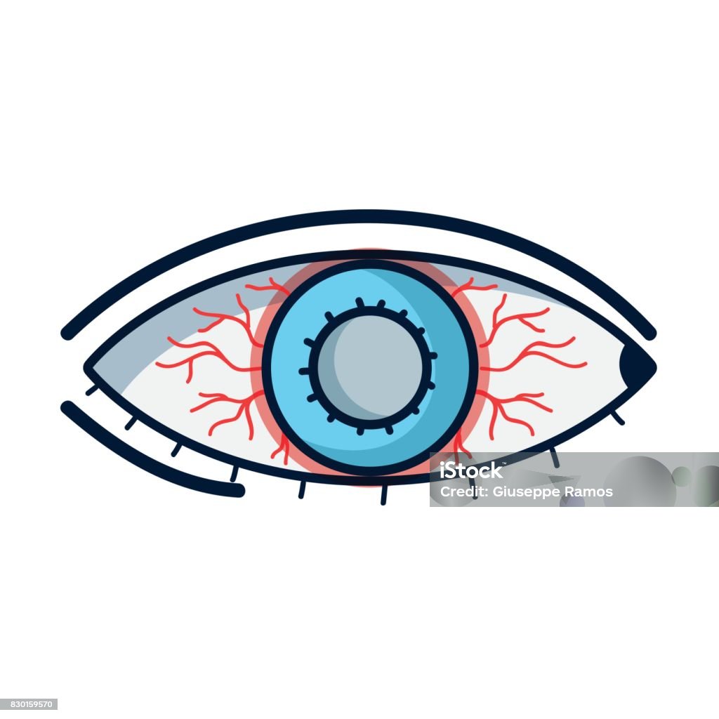 Ilustración De Ojos Con Conjuntivitis Enfermedad E Infección Y Más