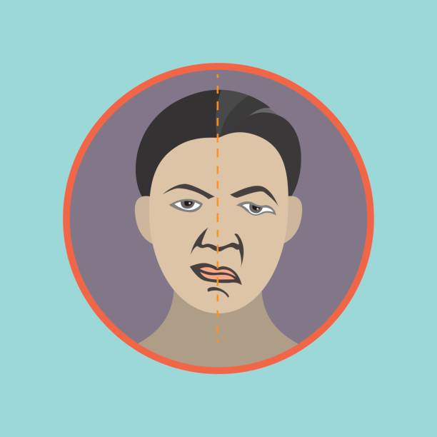 20 Bells Palsy Ilustrasi Grafik Vektor And Clip Art Bebas Royalti