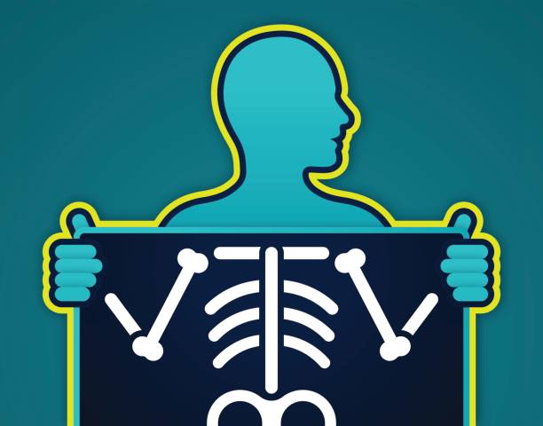 Free download of xray cartoon vector graphics and illustrations