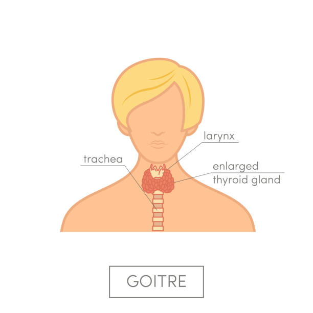 140 Thyroid Exam Ilustrasi Grafik Vektor And Clip Art Bebas Royalti