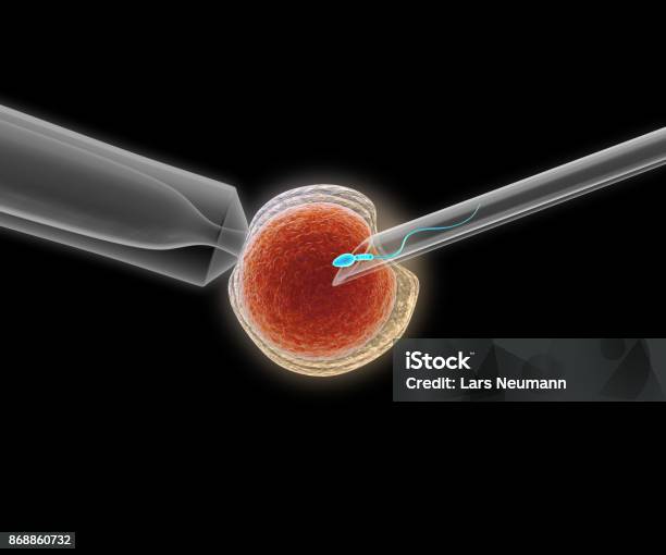 Icsi 과정단일 정자 난 자에 직접 주입의 3d 그림 정자에 대한 스톡 사진 및 기타 이미지 Istock
