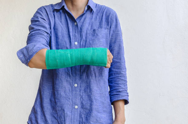 Arm Cast Pictures | Download Free Images on Unsplash