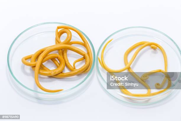 Ascariasis Adalah Penyakit Yang Disebabkan Oleh Cacing Gelang Parasit ... Ascariasis Adalah Penyakit Yang Disebabkan Oleh Cacing Gelang Parasit ...