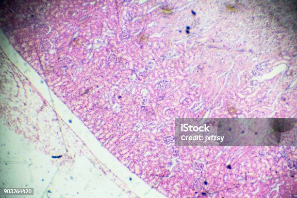 Kidney Biopsy Under Light Microscopy Stock Photo - Download Image Now ... Kidney Biopsy Under Light Microscopy Stock Photo - Download Image Now ...