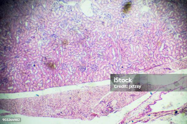 Kidney Biopsy Under Light Microscopy Stock Photo - Download Image Now ... Kidney Biopsy Under Light Microscopy Stock Photo - Download Image Now ...