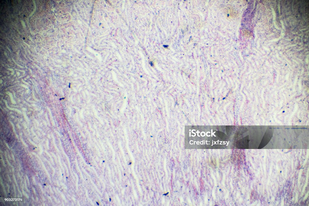 Kidney Biopsy Under Light Microscopy Stock Photo - Download Image Now ... Kidney Biopsy Under Light Microscopy Stock Photo - Download Image Now ...