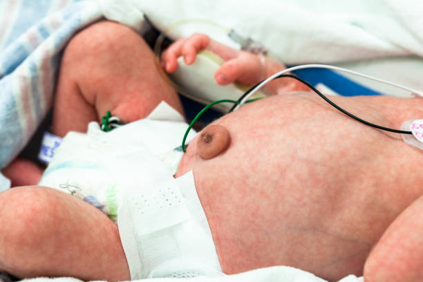 Newborn Belly Button Discharge