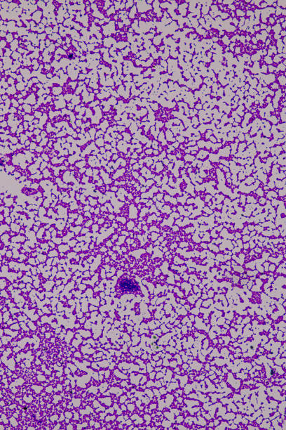 Bacteria on slide under the microscope constitute a large domain of ...