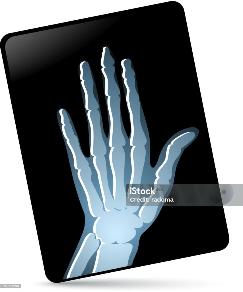 X선 손 X 레이에 대한 스톡 벡터 아트 및 기타 이미지 X 레이 건강 진단 건강관리와 의술 Istock